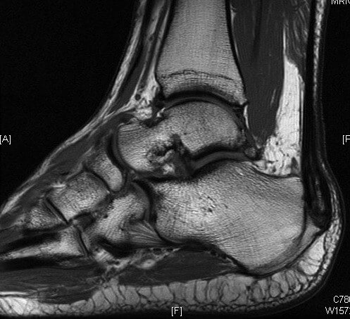 Medical Investigations and Imaging For Your LFAC Consultation