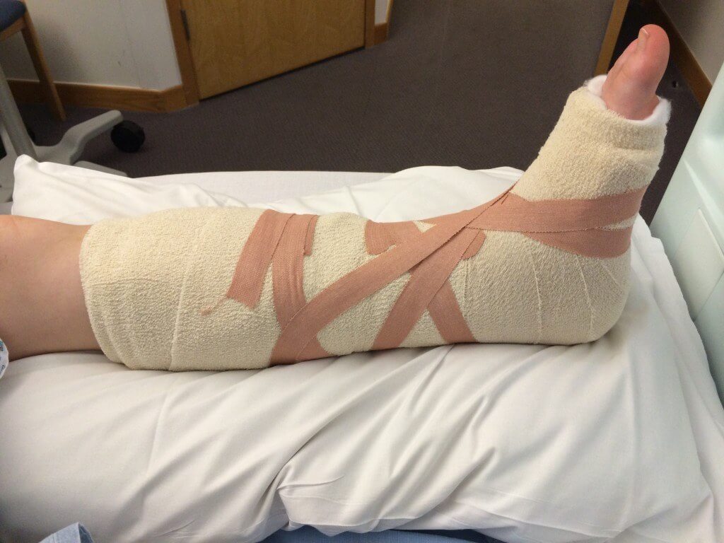 Patient Information | After Your Foot and Ankle Surgery