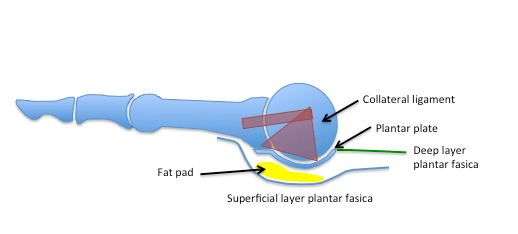 Claw Toe | Claw Toe Deformity | LFAC